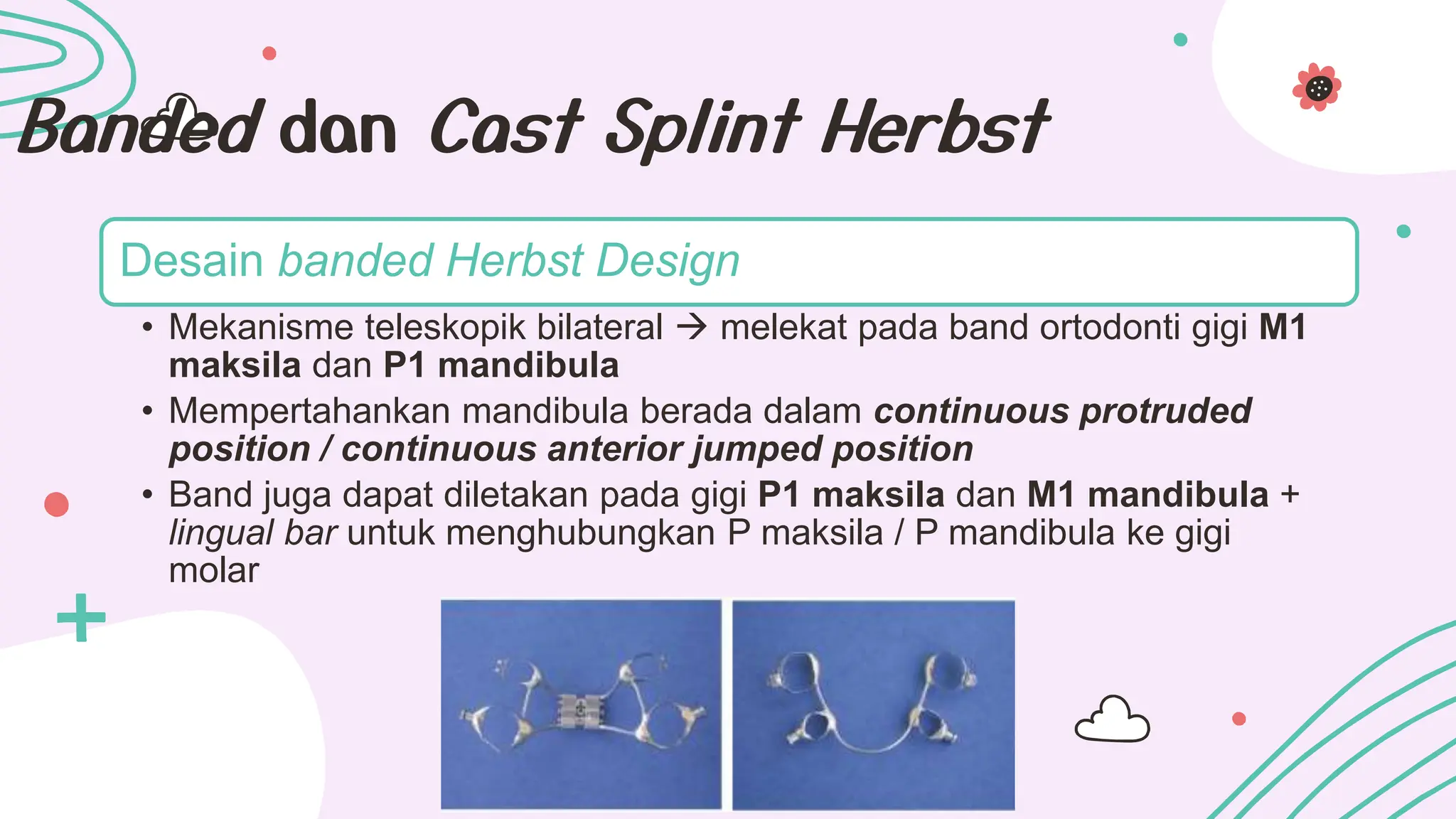 Herbst appliance in orthodontic power point | PPTX