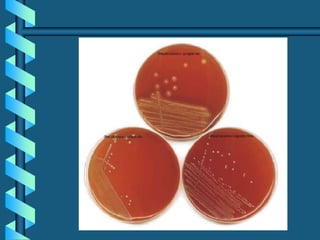 Culture Techniques and Maintenance of selected cultures | PPTX