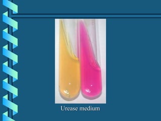 Culture Techniques and Maintenance of selected cultures | PPTX