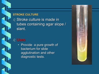 Culture Techniques and Maintenance of selected cultures | PPTX
