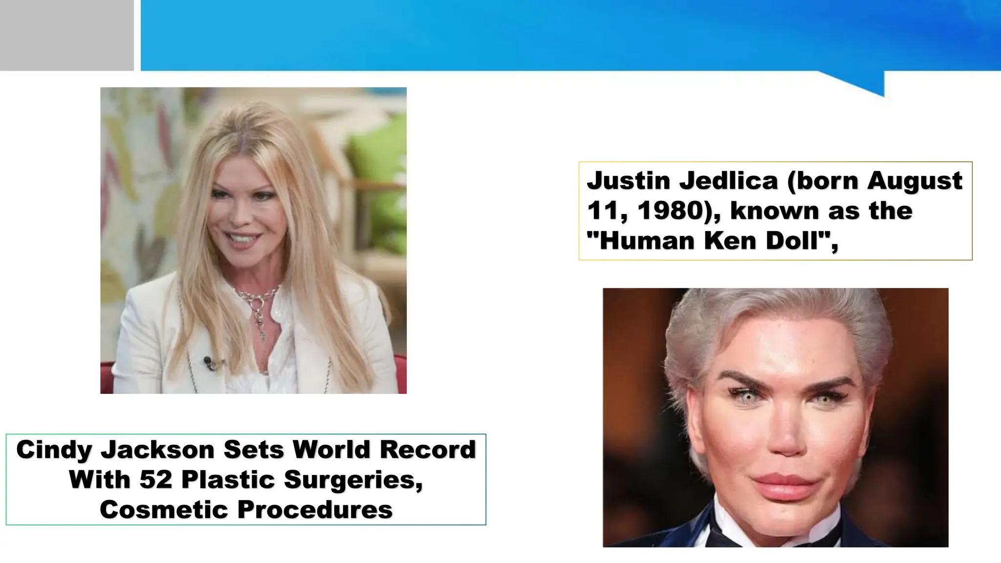 BURNS RECONSTRUCTIVE SURGERY.pptx [medical surgical nursing] | PPTX