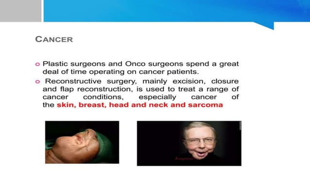 BURNS RECONSTRUCTIVE SURGERY.pptx [medical surgical nursing] | PPTX