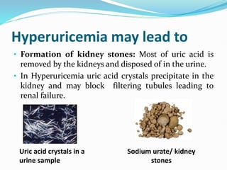 2. CREATININE UREA AND URIC ACID 2_2.pptx
