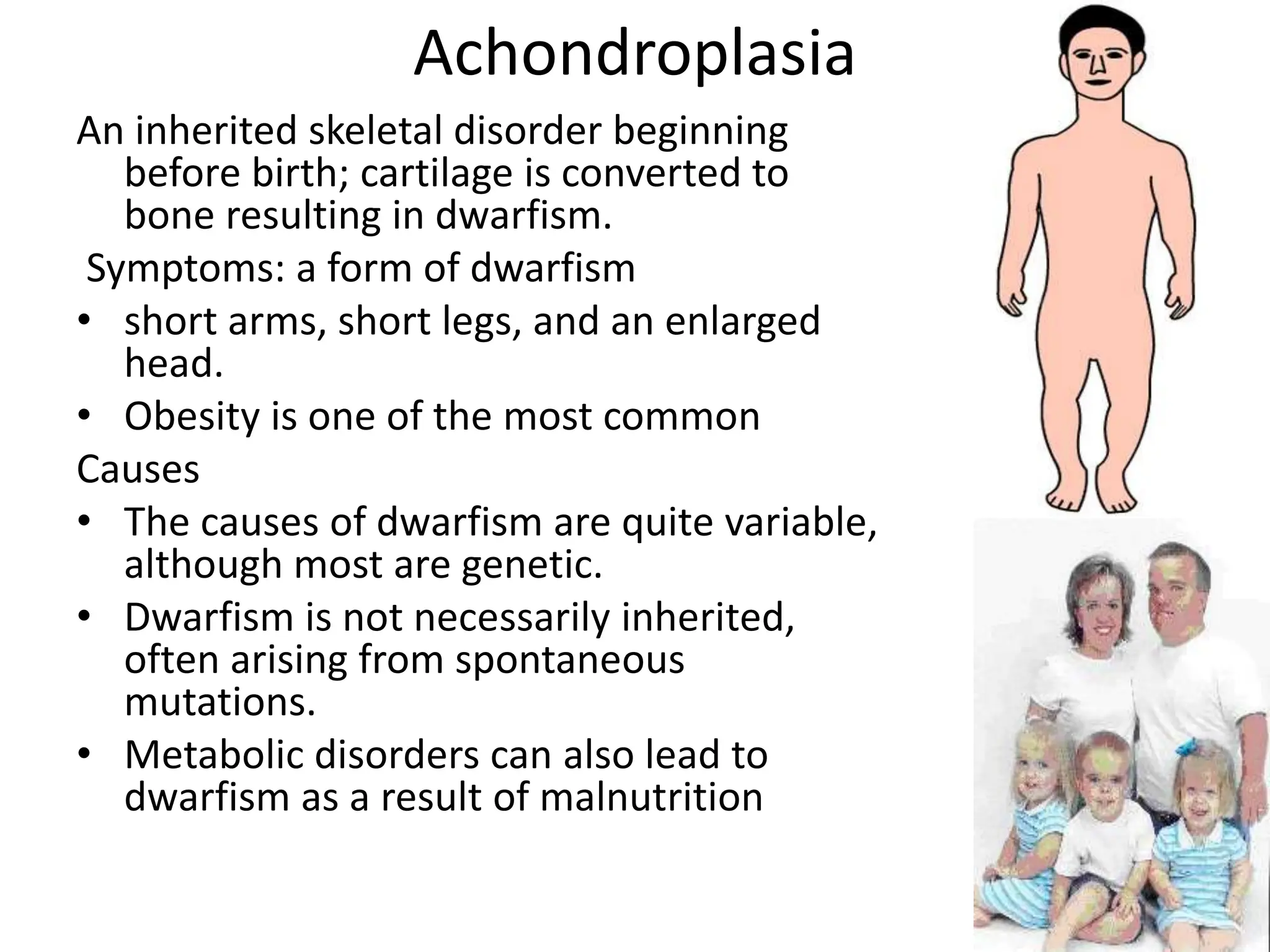 PPT ON Congenital anomalies.pptx