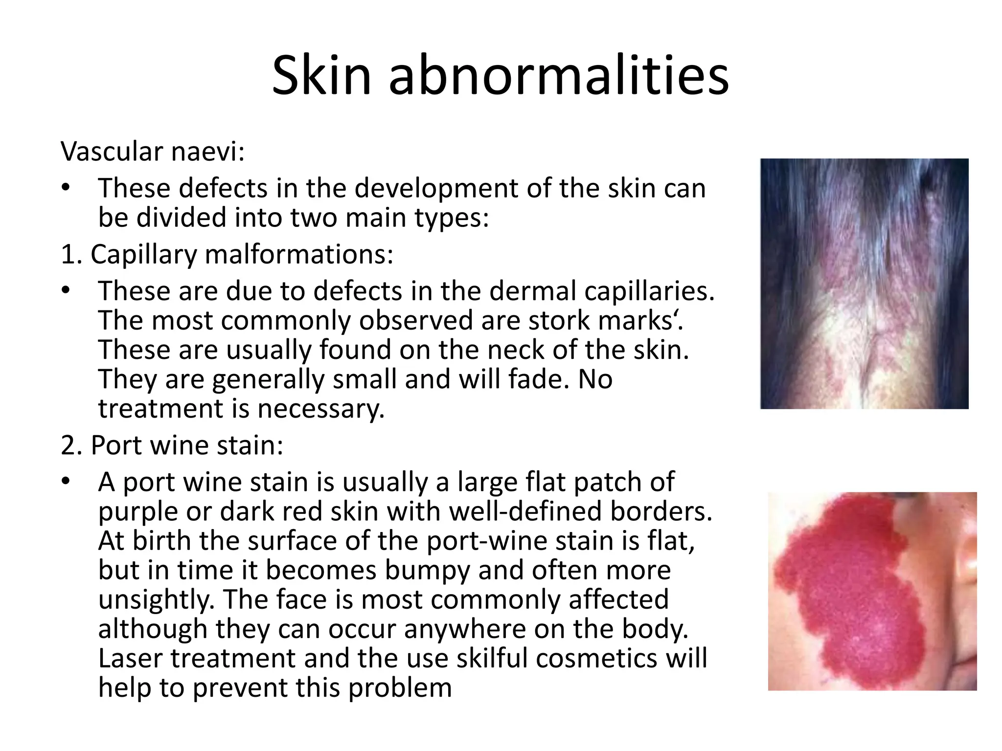 PPT ON Congenital anomalies.pptx