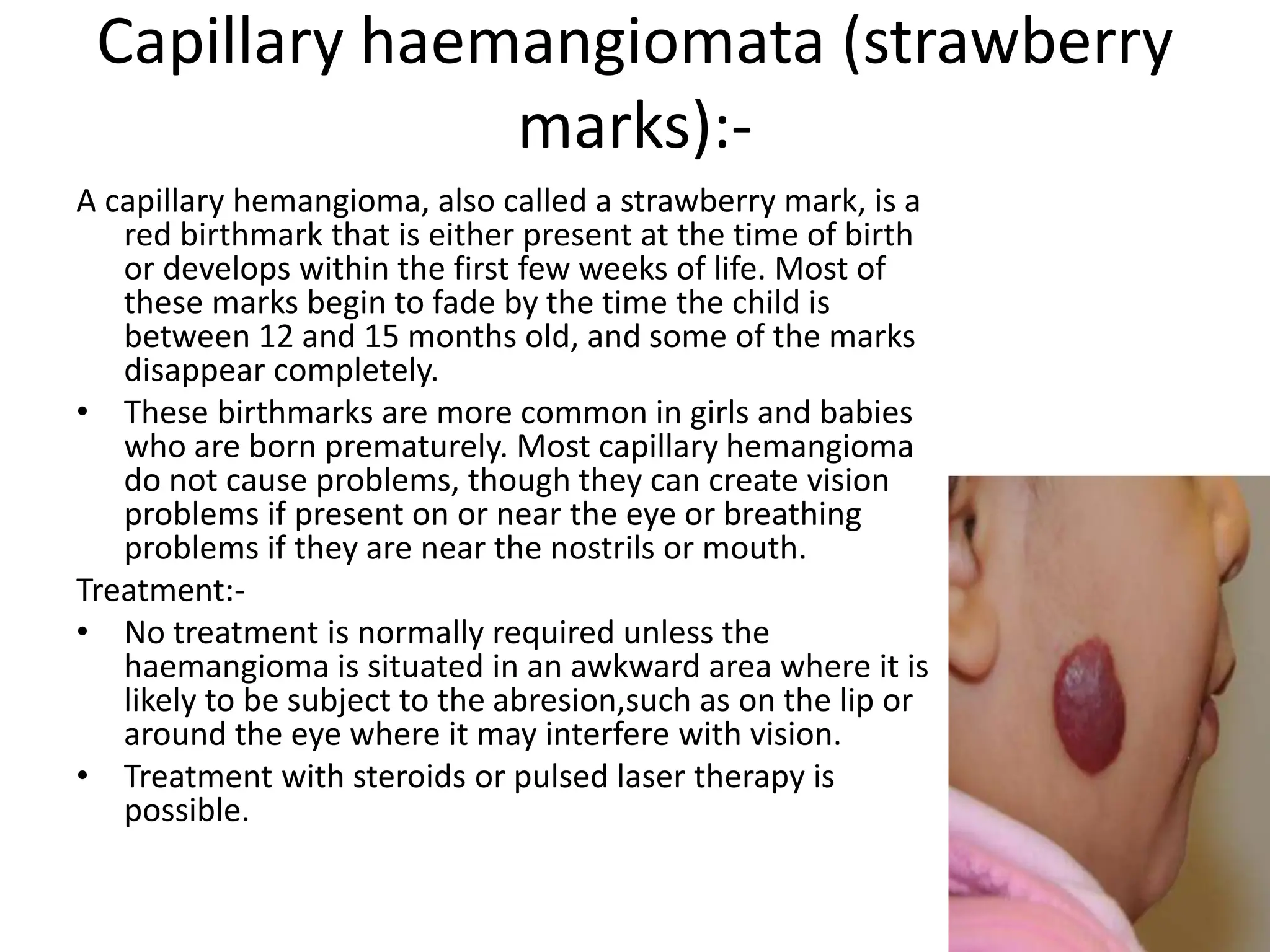 PPT ON Congenital anomalies.pptx