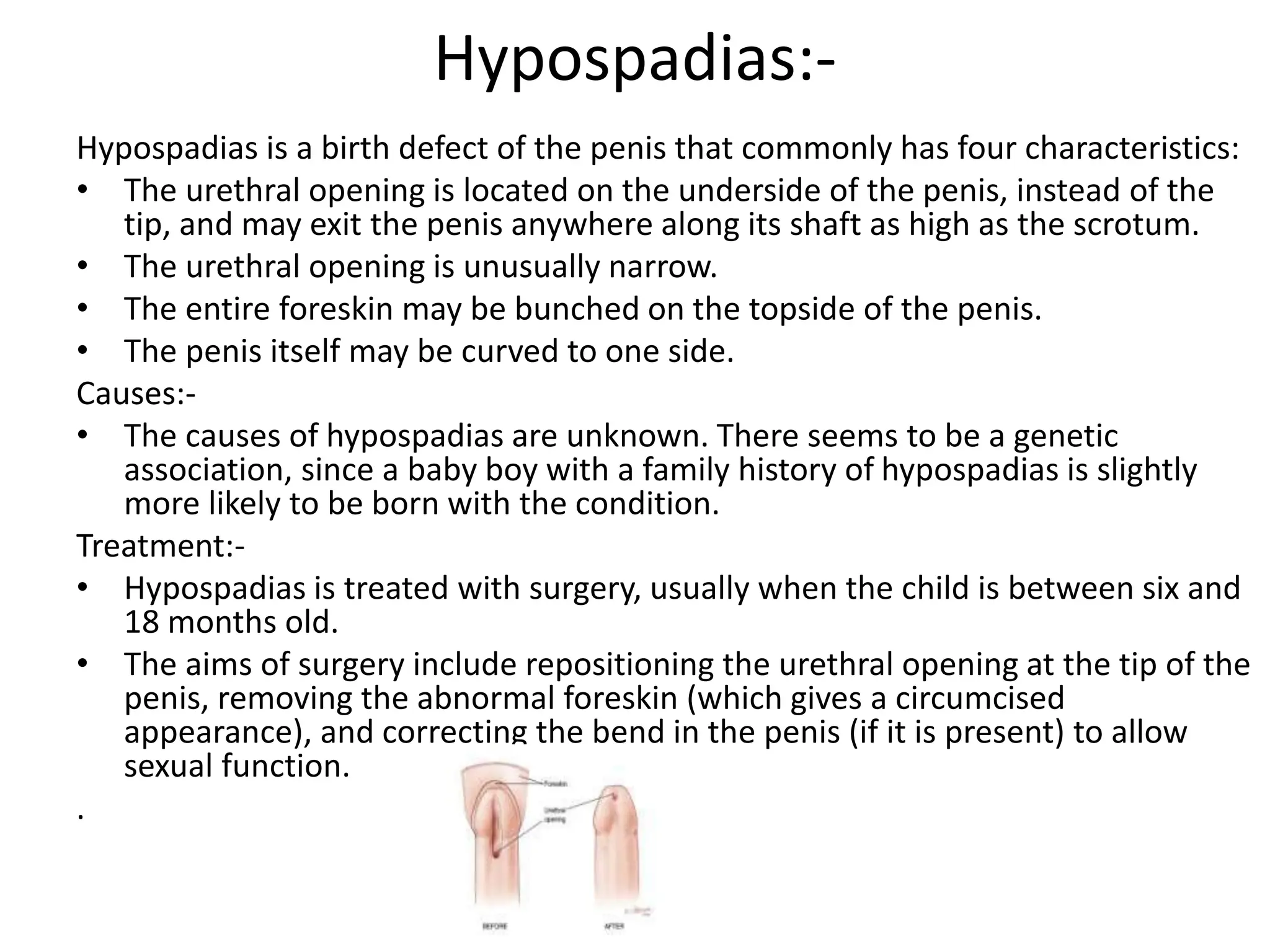 PPT ON Congenital anomalies.pptx