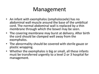 PPT ON Congenital anomalies.pptx