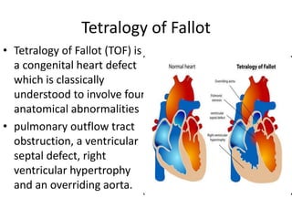PPT ON Congenital anomalies.pptx