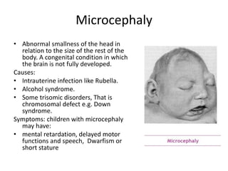PPT ON Congenital anomalies.pptx
