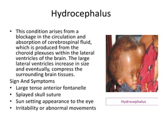 PPT ON Congenital anomalies.pptx