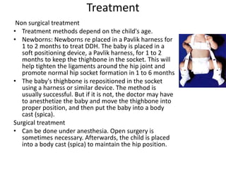 PPT ON Congenital anomalies.pptx