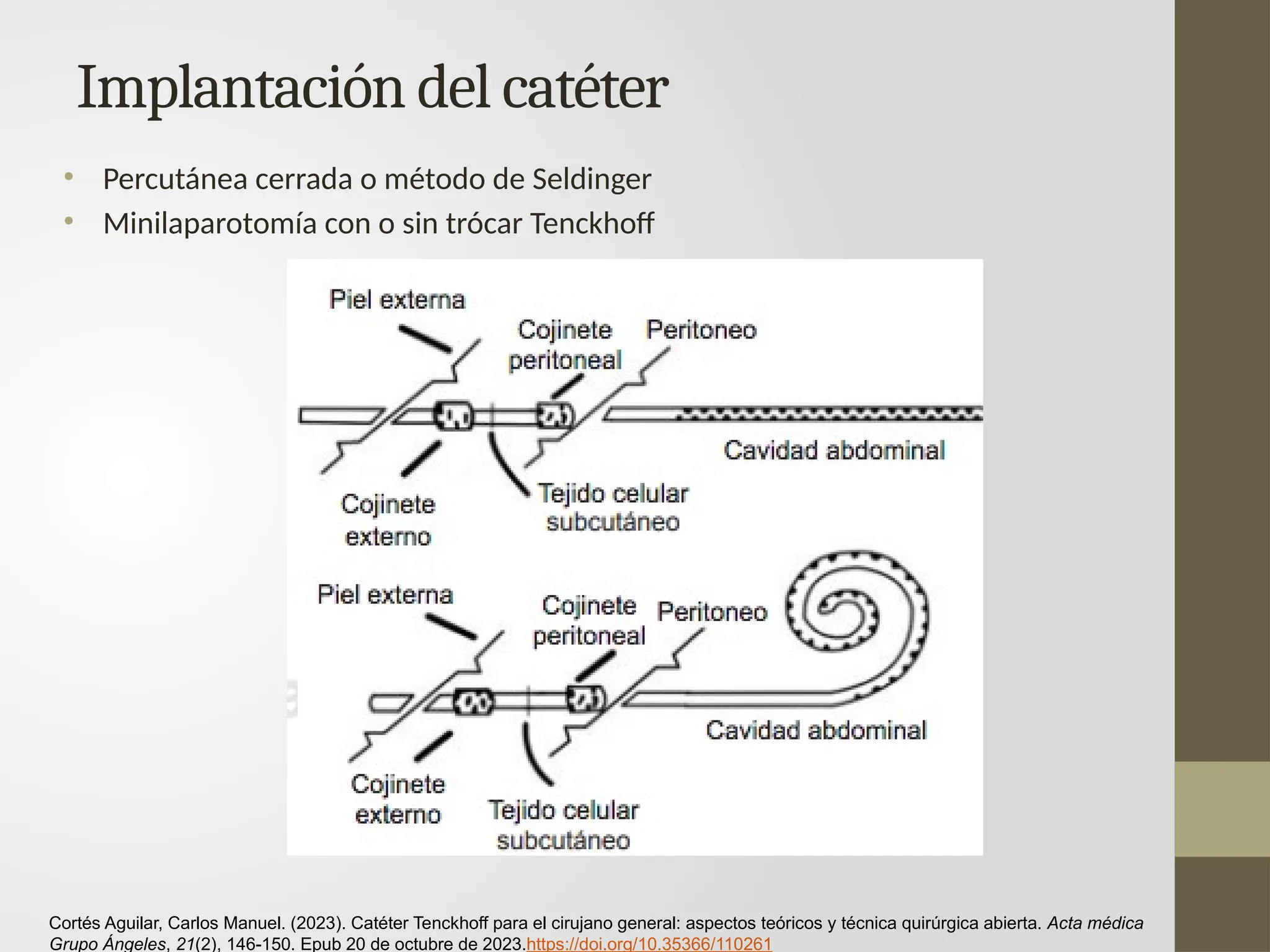 técnica de colocación de cateter Tenckhoff | PPTX