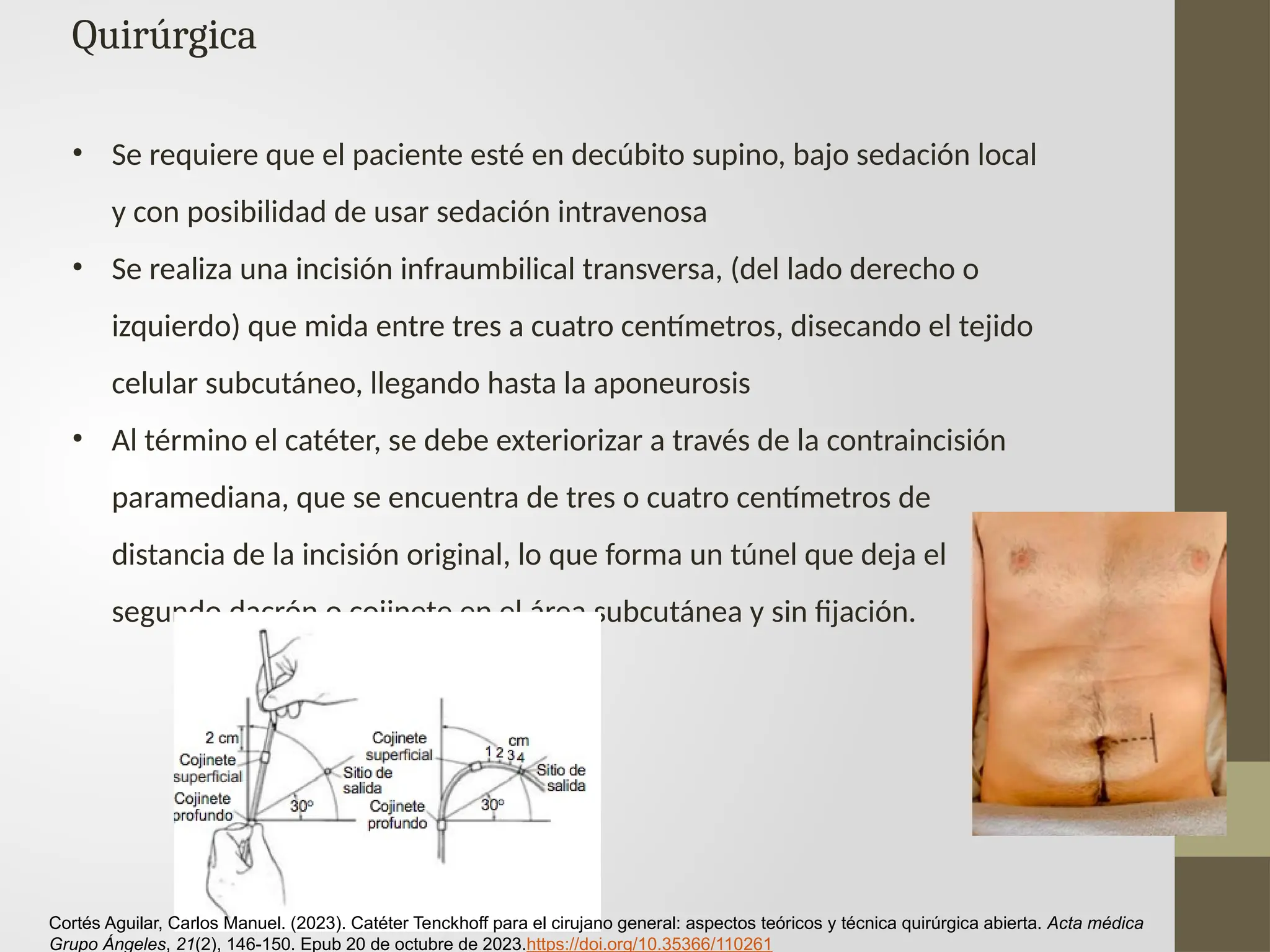 técnica de colocación de cateter Tenckhoff | PPTX