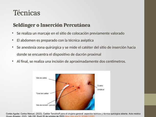 técnica de colocación de cateter Tenckhoff | PPTX