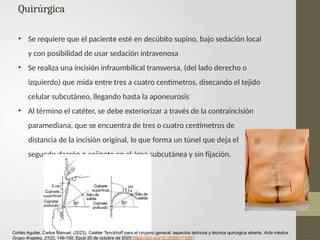 técnica de colocación de cateter Tenckhoff | PPTX