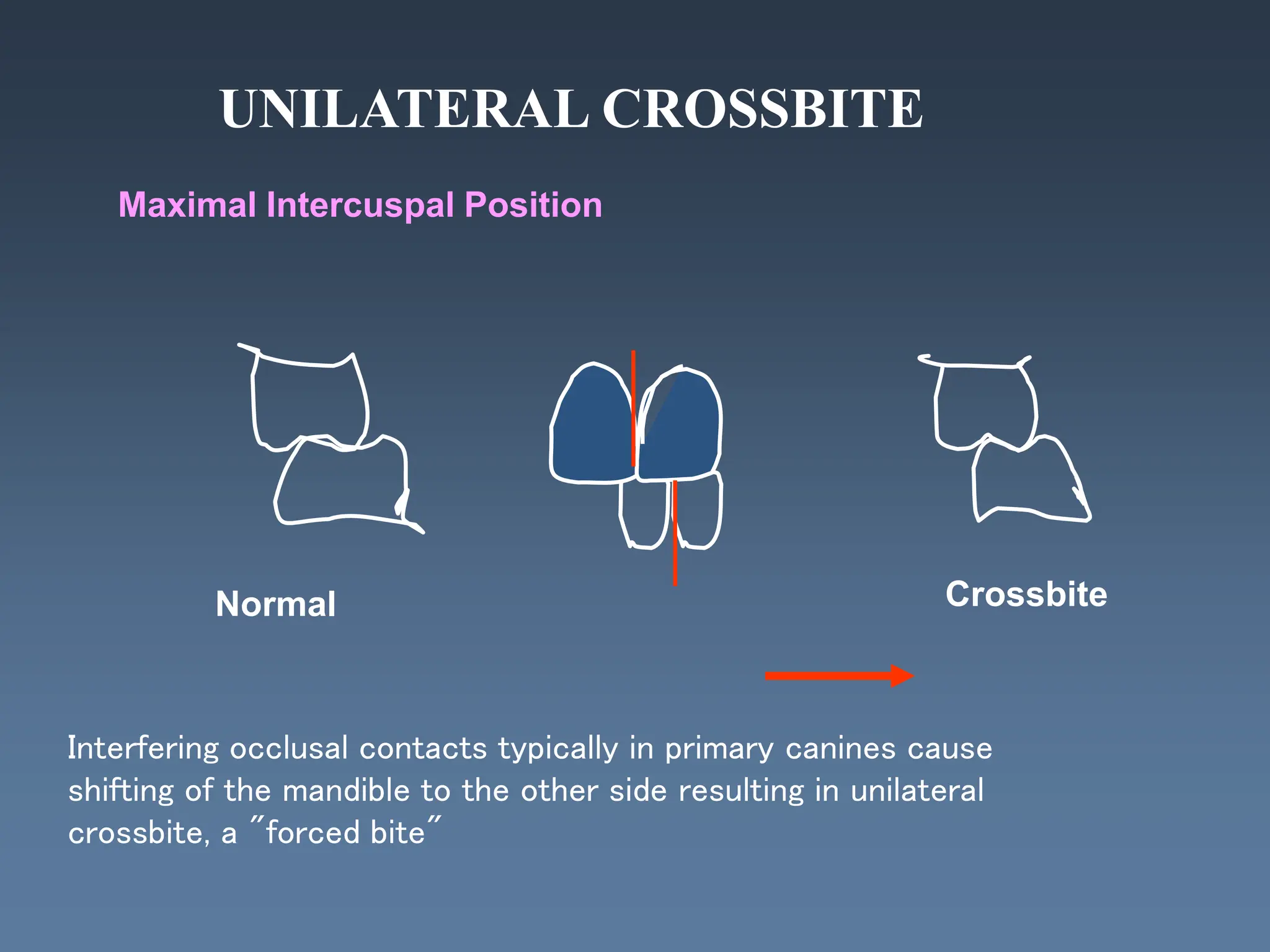 2. Etiology and epidemiology of malocclusion.ppt