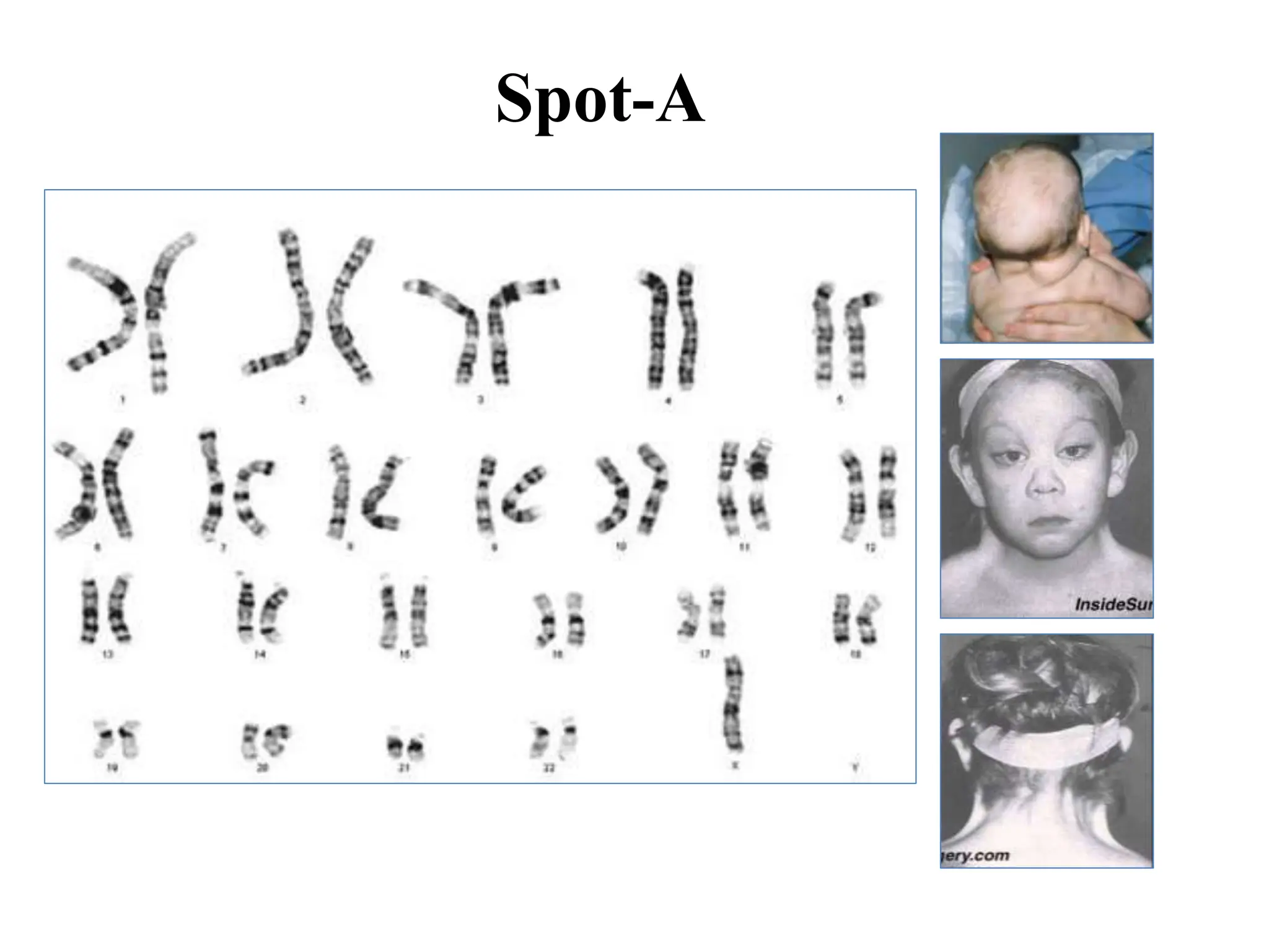 Genetics pRACTICAL Spotting Exam 2022.pptx