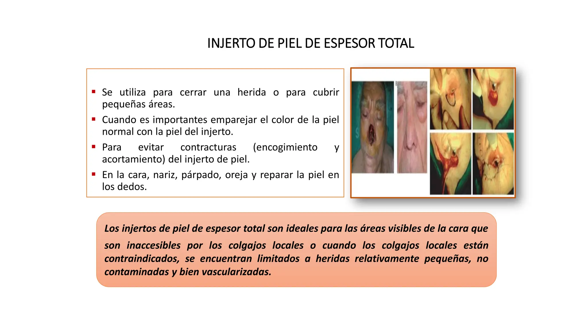 2.INJERTO Y COLGAJO CUIDADOS DE ENFERMERIA | PDF
