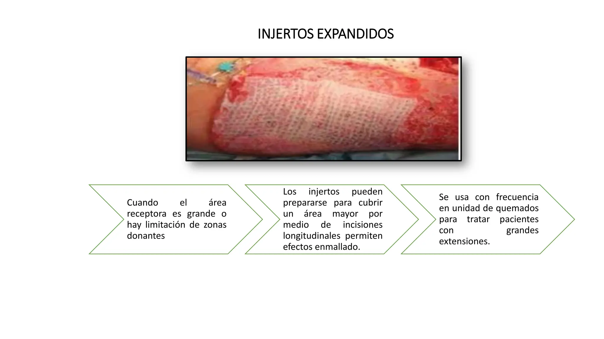2.INJERTO Y COLGAJO CUIDADOS DE ENFERMERIA | PDF