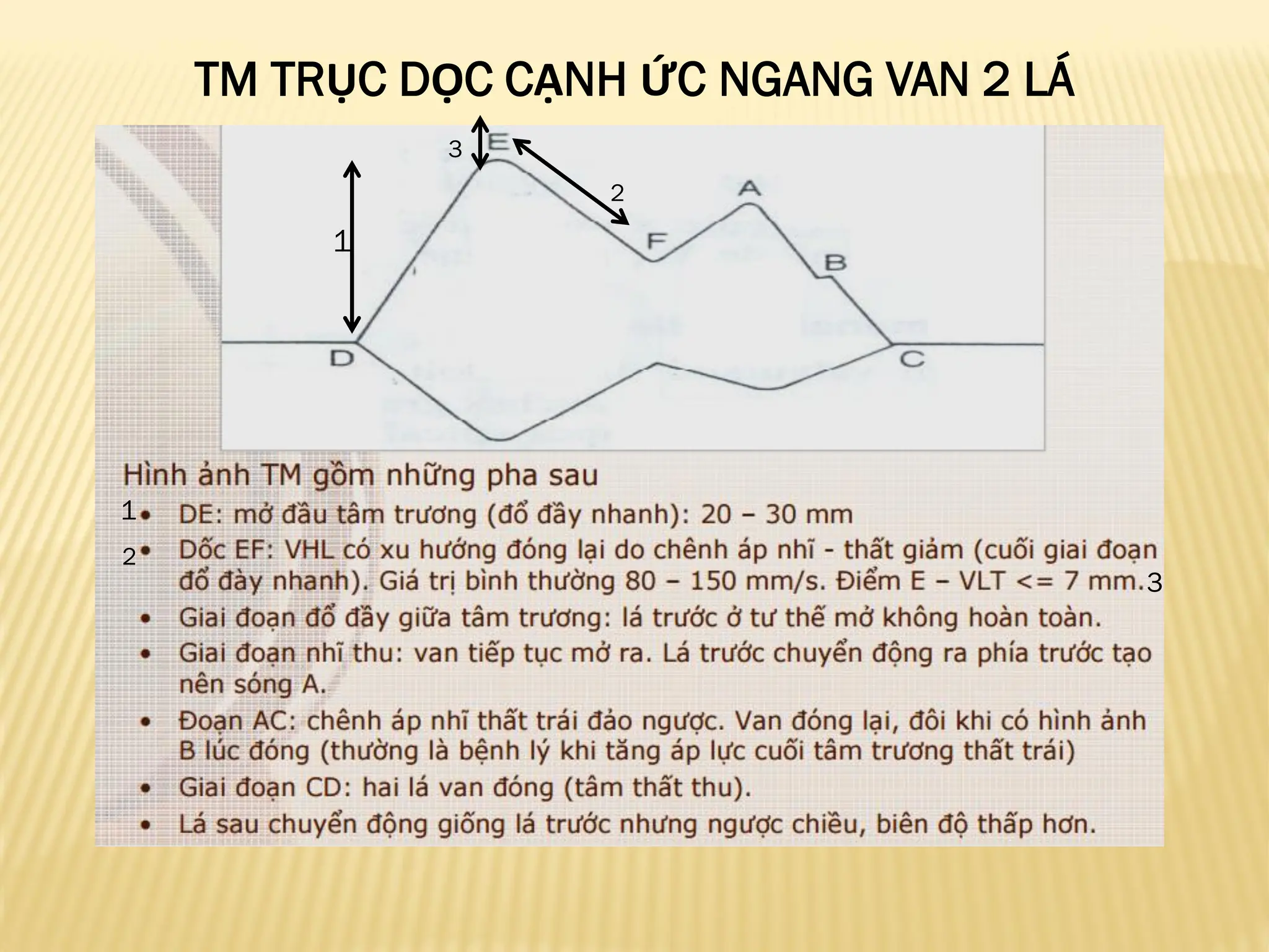 2.Siêu âm tim bình thường- BS TRANG ĐHYDNG | PDF