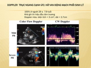 2.Siêu âm tim bình thường- BS TRANG ĐHYDNG | PDF