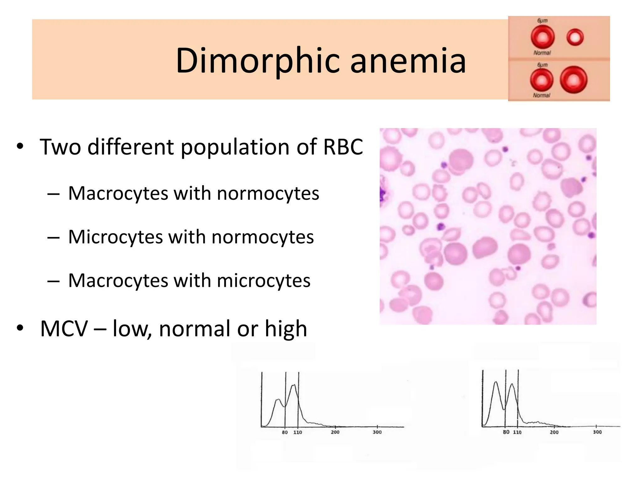 Peripheral blood smeared examination test | PDF