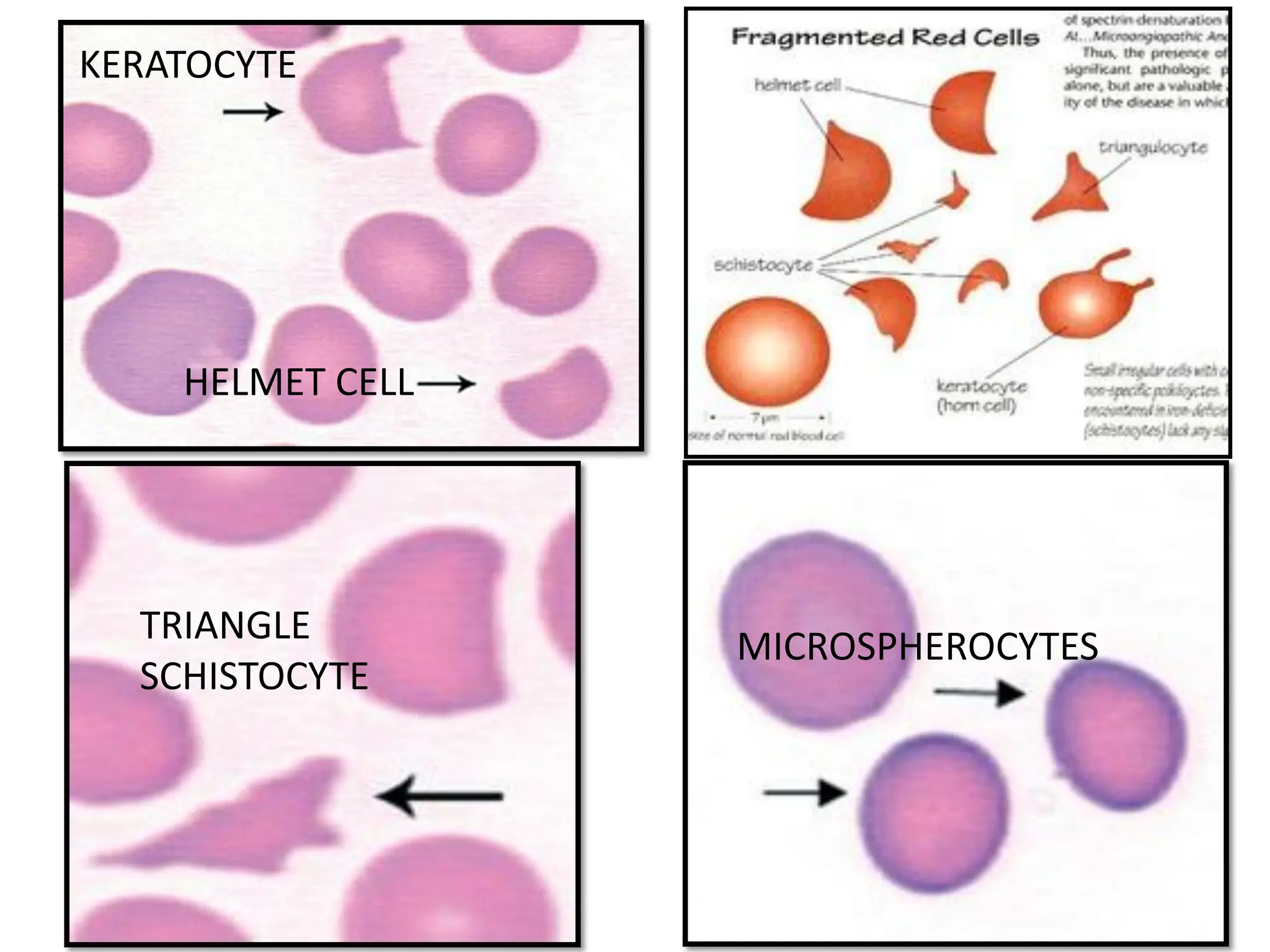 Peripheral blood smeared examination test | PDF