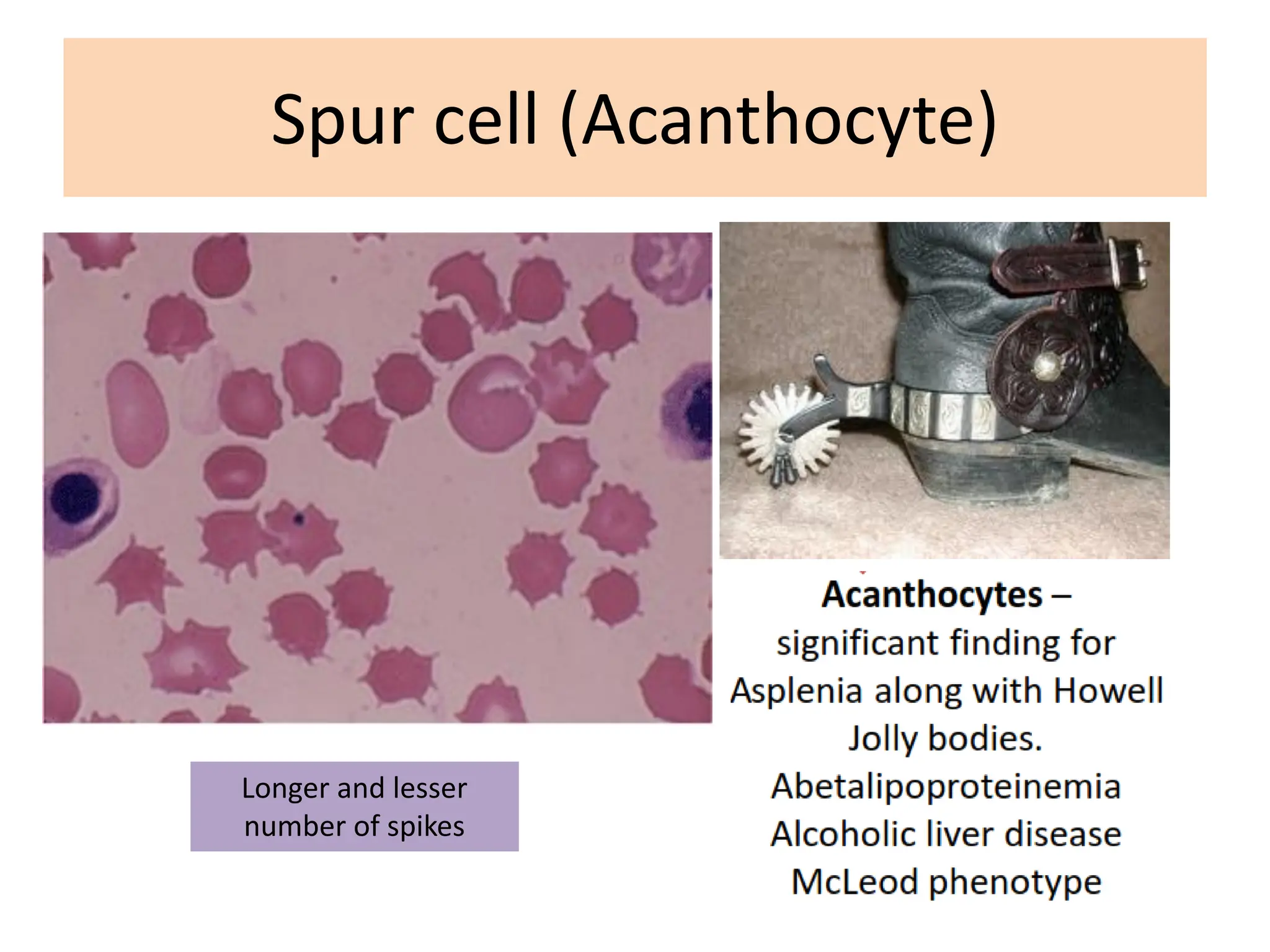 Peripheral blood smeared examination test | PDF