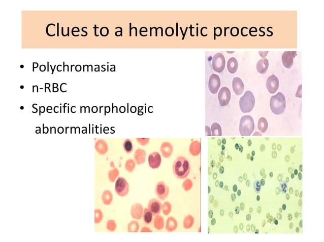 Peripheral blood smeared examination test | PPT