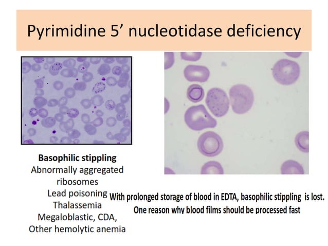 Peripheral blood smeared examination test | PPT