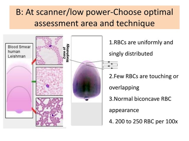 Peripheral blood smeared examination test | PPT