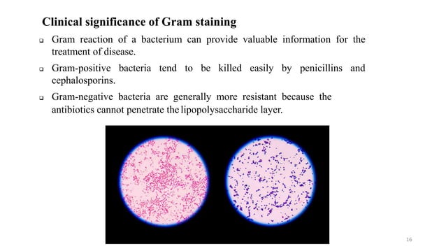 Identification of bacteria using staining techniques | PPTX