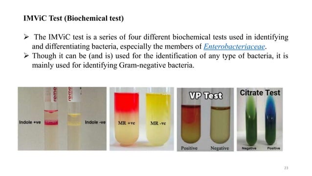 Identification of bacteria using staining techniques | PPTX