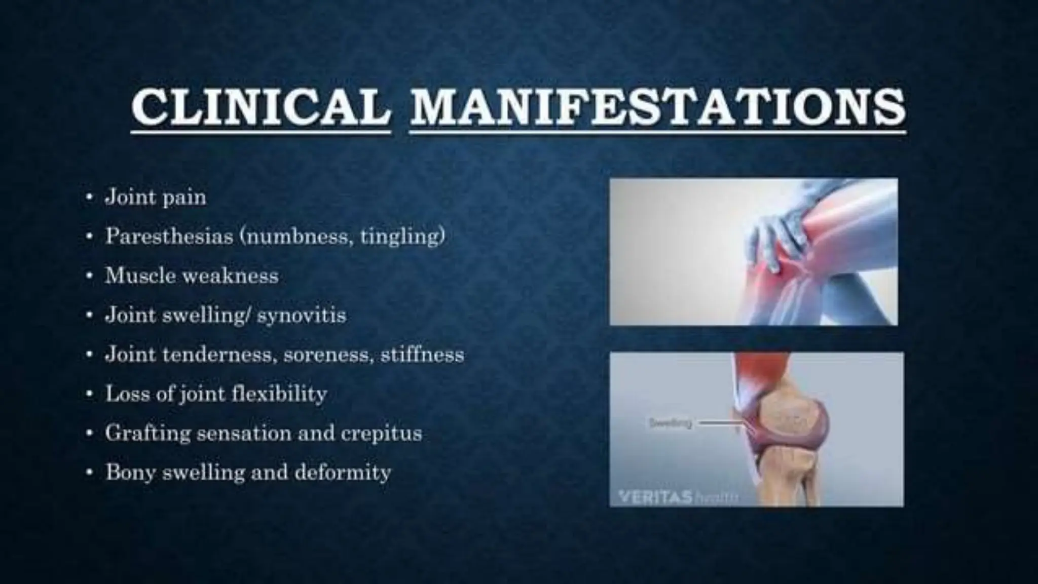 Diseases of bones and joint(Pathophysiology of Osteoarthritis) | PPTX