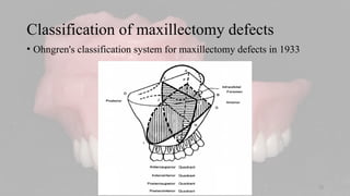 Maxillomandibular defects and treatment.pptx