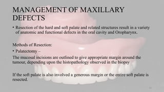 Maxillomandibular defects and treatment.pptx