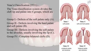 Maxillomandibular defects and treatment.pptx