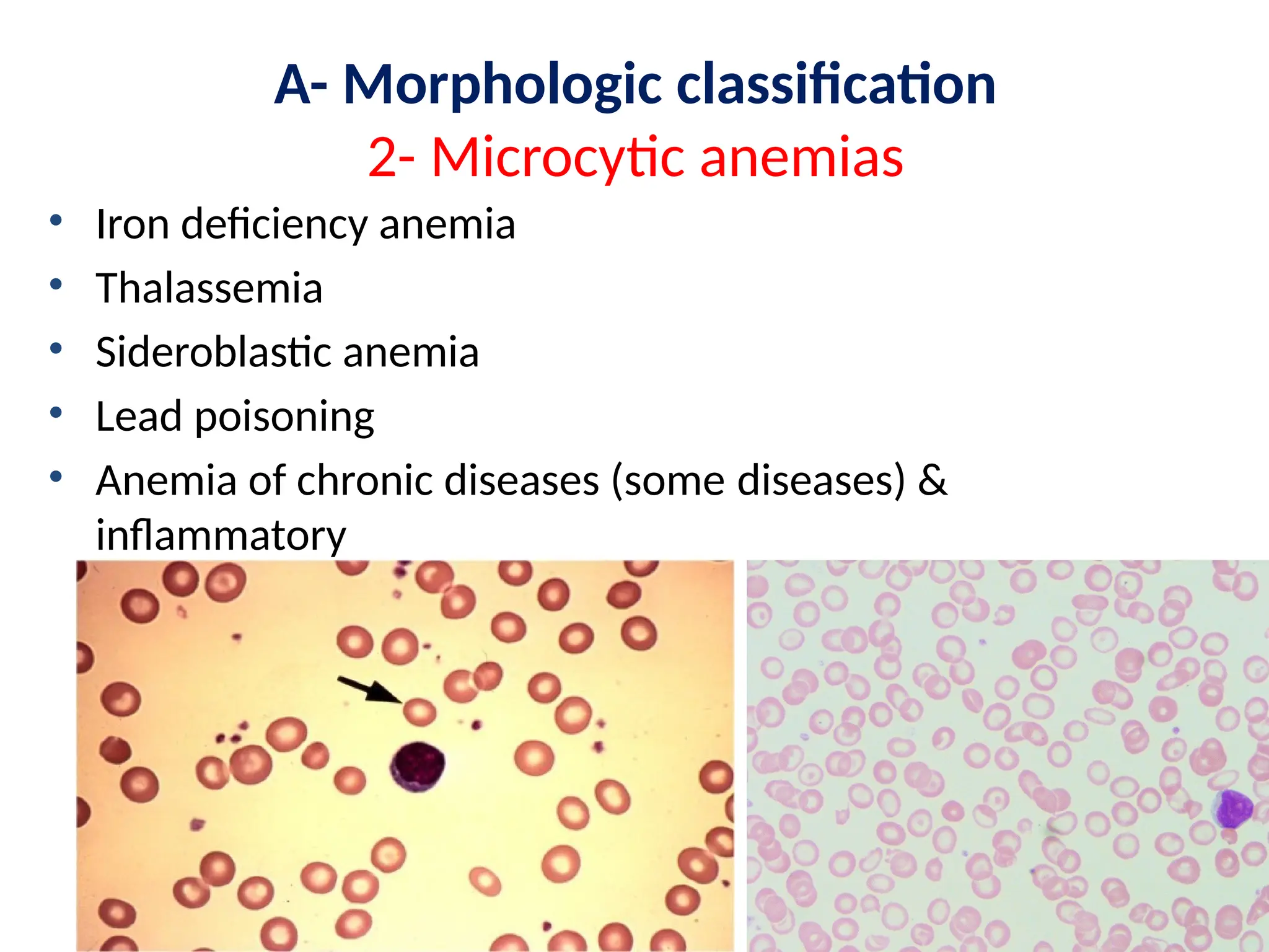 2.anemia classification system class.pptx
