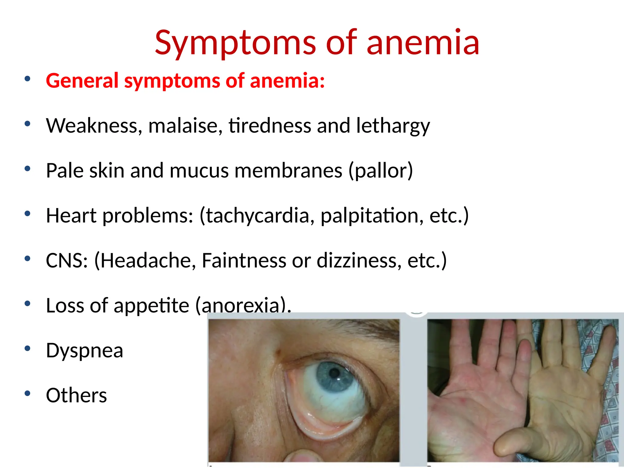 2.anemia classification system class.pptx