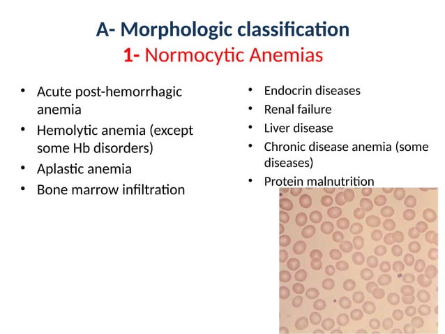 2.anemia classification system class.pptx