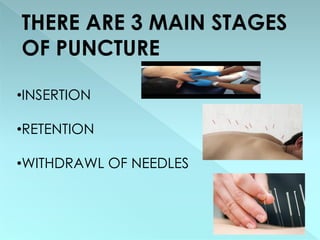 2.2 TECHNIQUES OF NEEDLING AND SKIN DISINFECTION.pptx.pdf