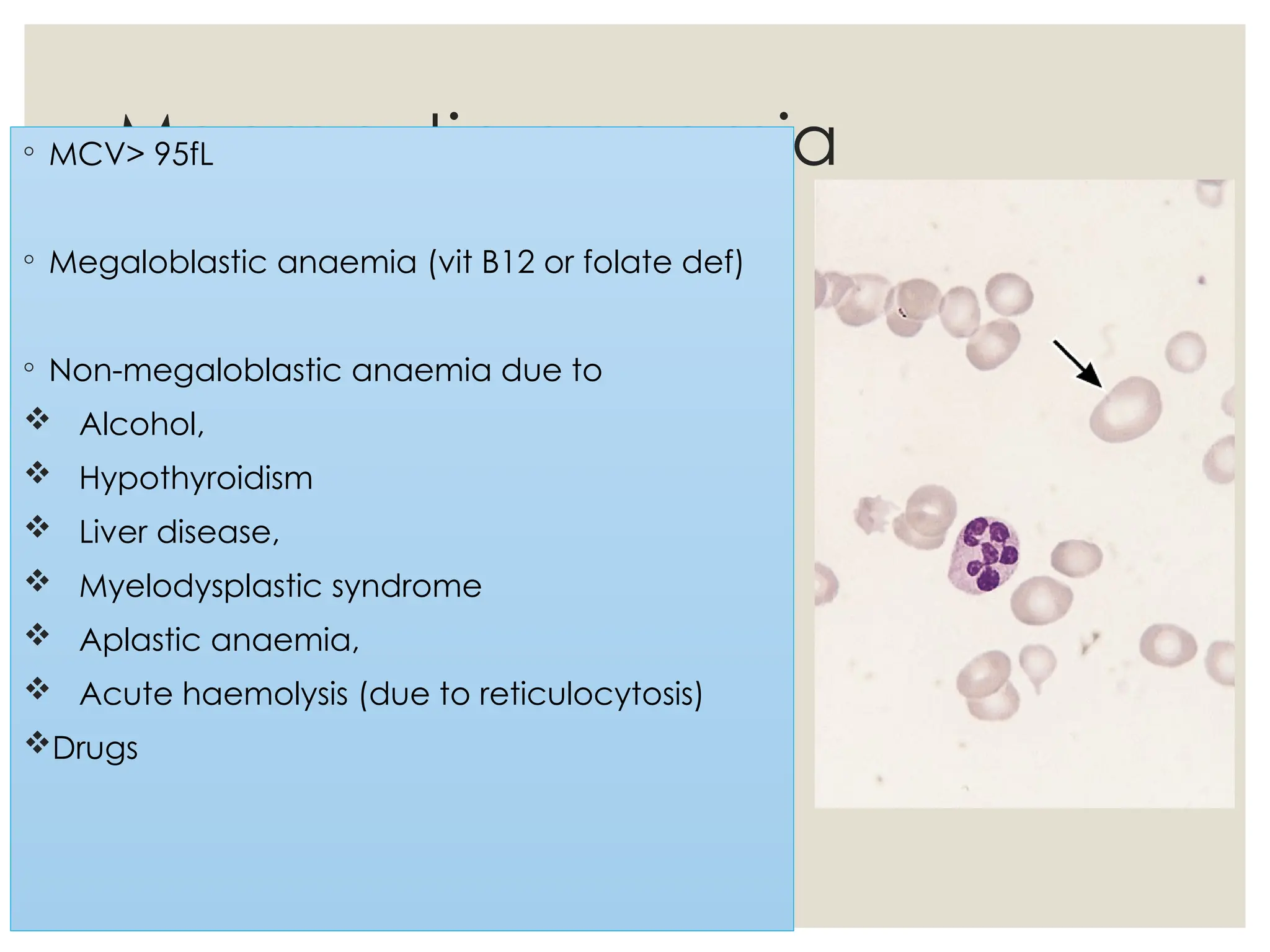 Approach to Patients with Anemia Disease | PPTX
