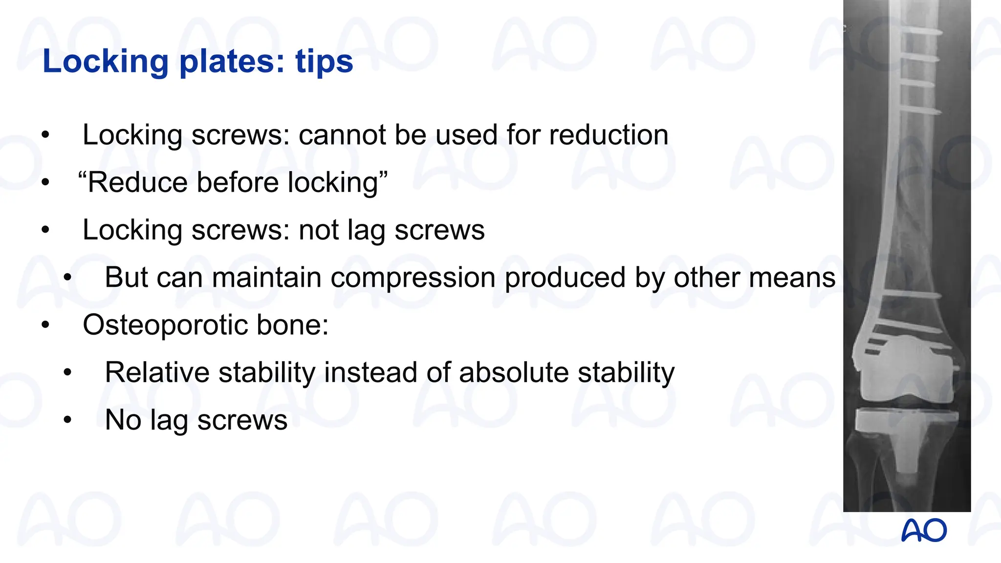 plates in fracture fixation on orthopedic | PDF