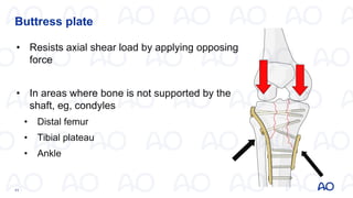 plates in fracture fixation on orthopedic | PPT