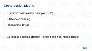 plates in fracture fixation on orthopedic | PPT