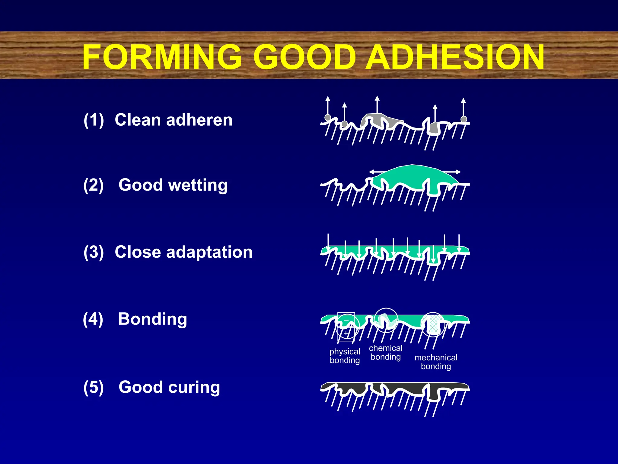 Prosedur Bonding pada material resin komposit | PPT