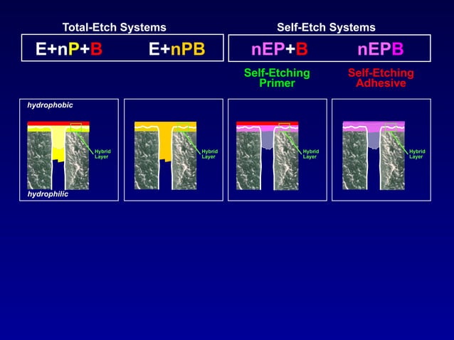 Prosedur Bonding pada material resin komposit | PPT