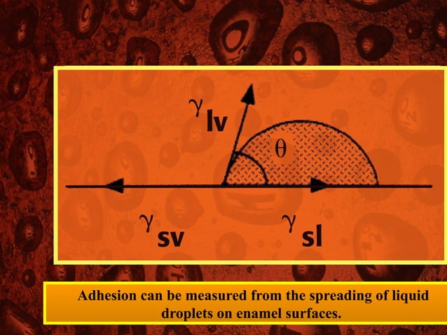 Prosedur Bonding pada material resin komposit | PPT