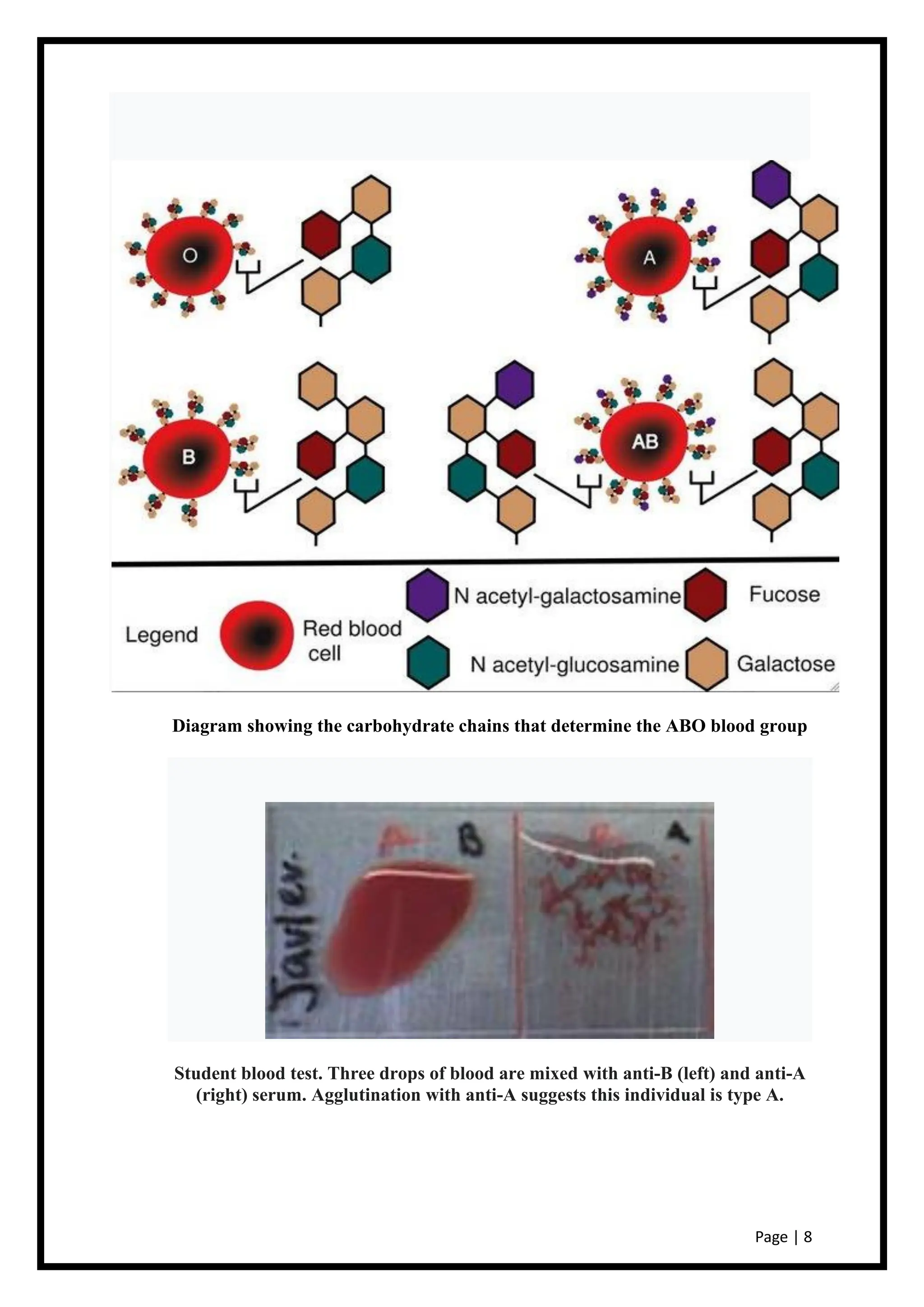 ABO Blood Grouping Biology Investigatory Project Class XII(12) | PDF